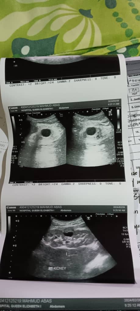 NephroRegen - Regenerates & repairs kidney damages. Restores healthy ...